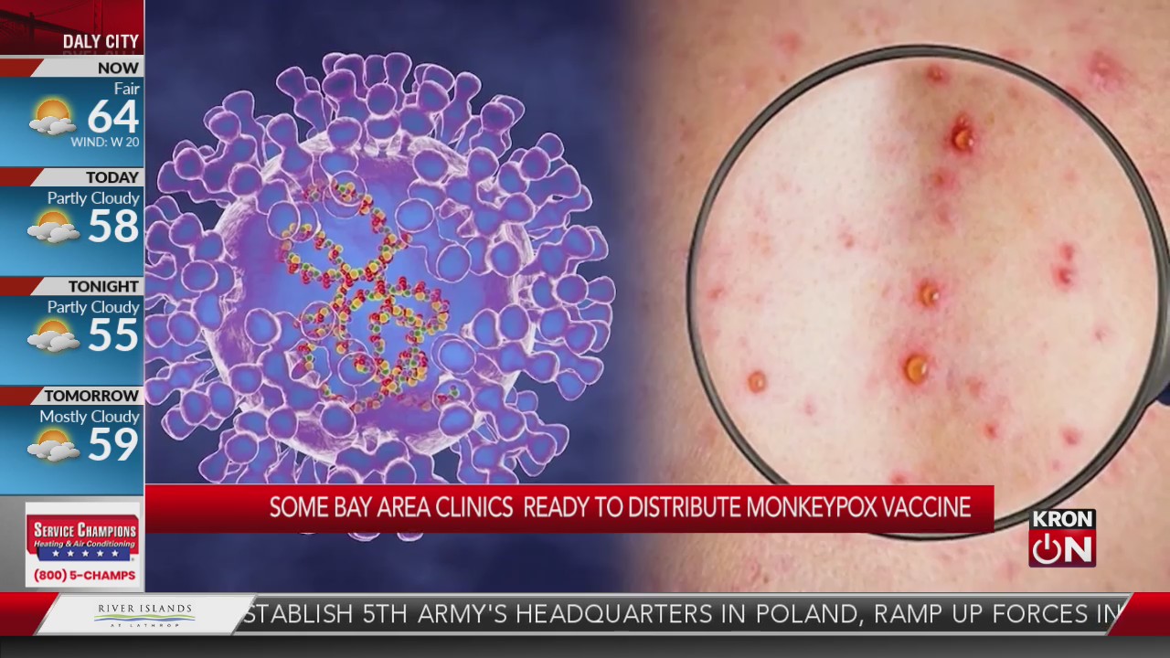 Some Bay Area clinics to distribute monkeypox vaccine – KRON4