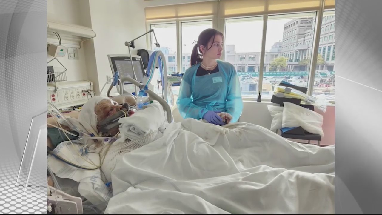Son speaks out after father is injured at Martinez refinery – KRON4
