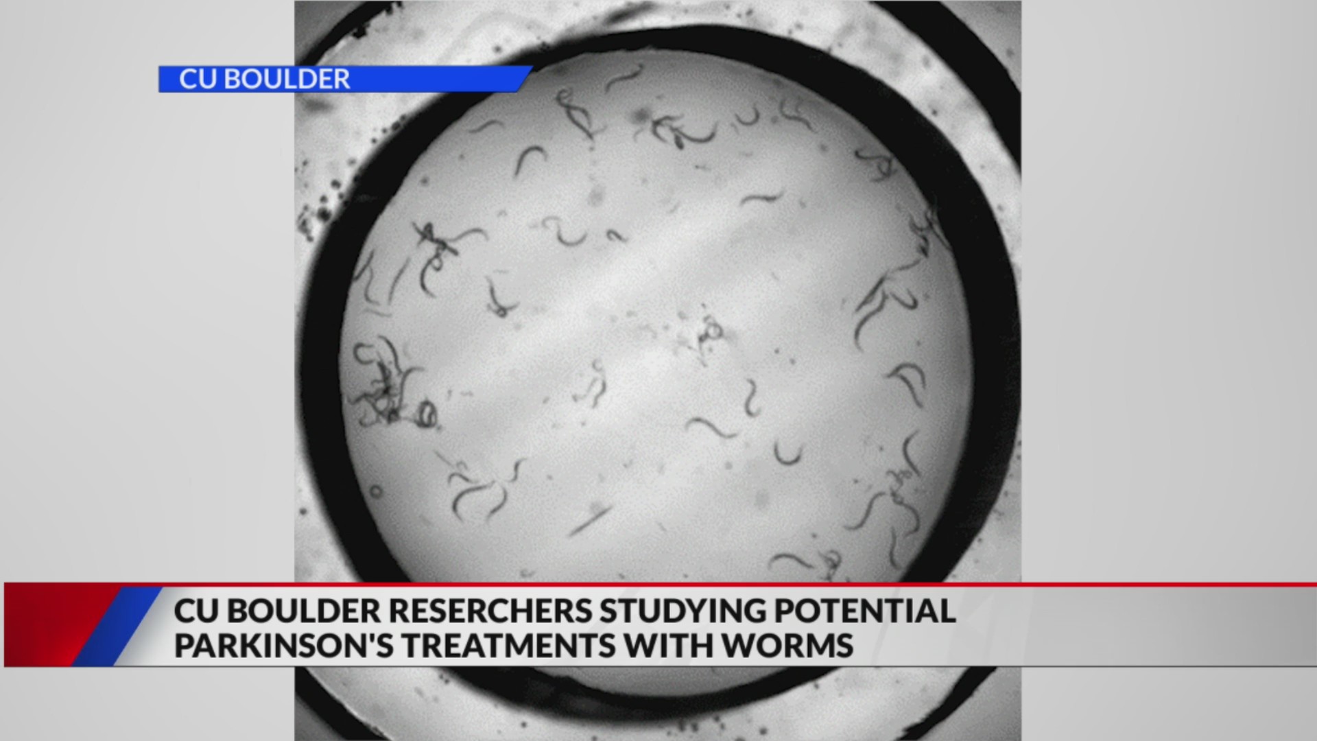 CU Boulder research could lead to potential breakthrough in Parkinson’s ...