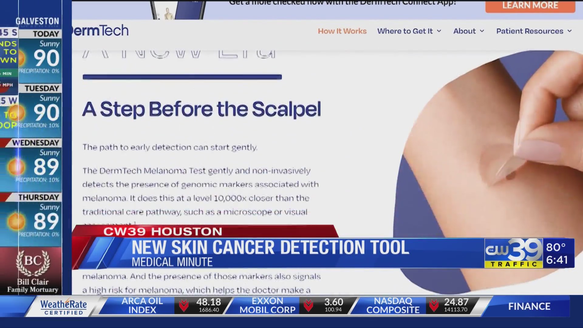 Skin cancer detecting sticker instead of painful biopsy – Medical ...