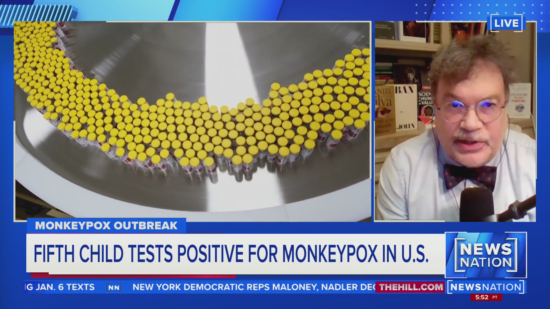 Monkeypox: 5th child comes down with disease | NewsNation Prime ...