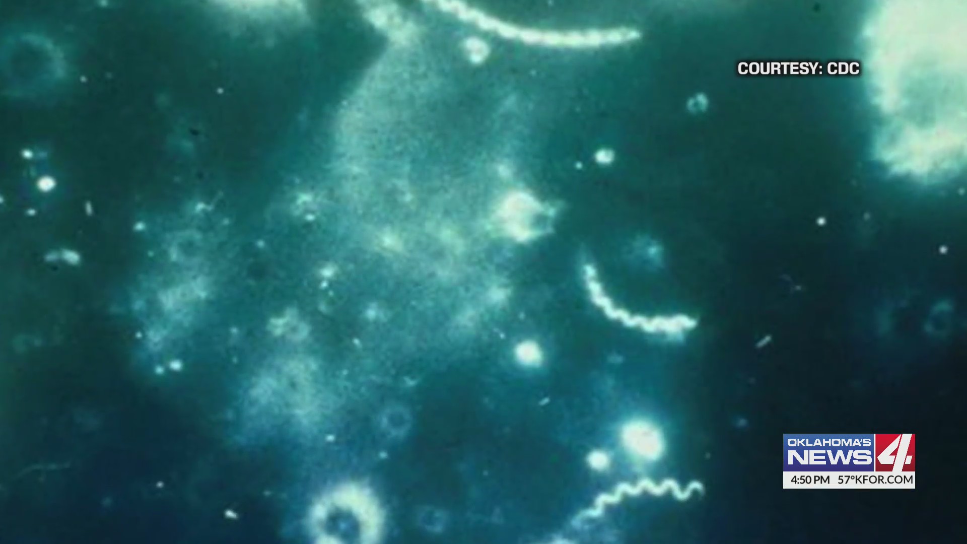 Syphilis cases rise to highest levels since the 1950s – KFOR.com ...