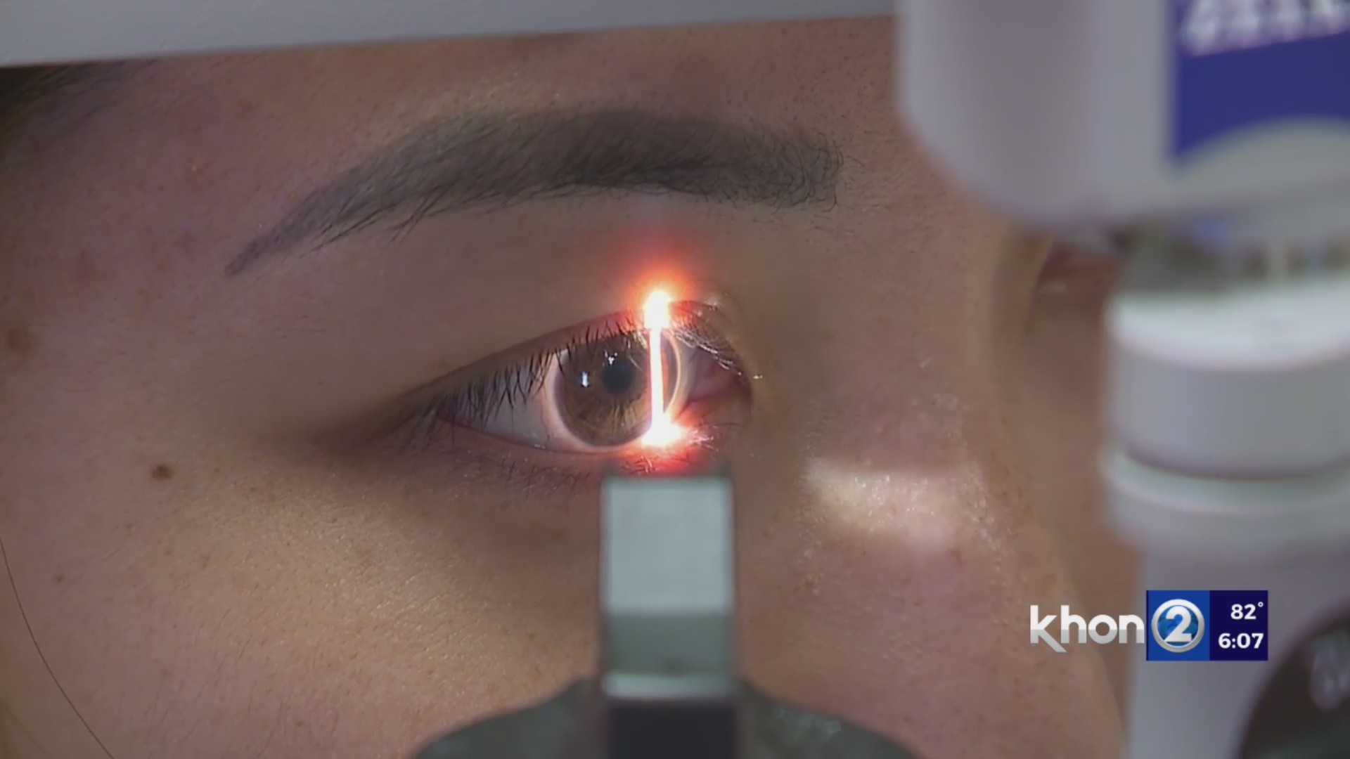 eye-opening cancer diagnosis after forgetting lenses at home – KHON2