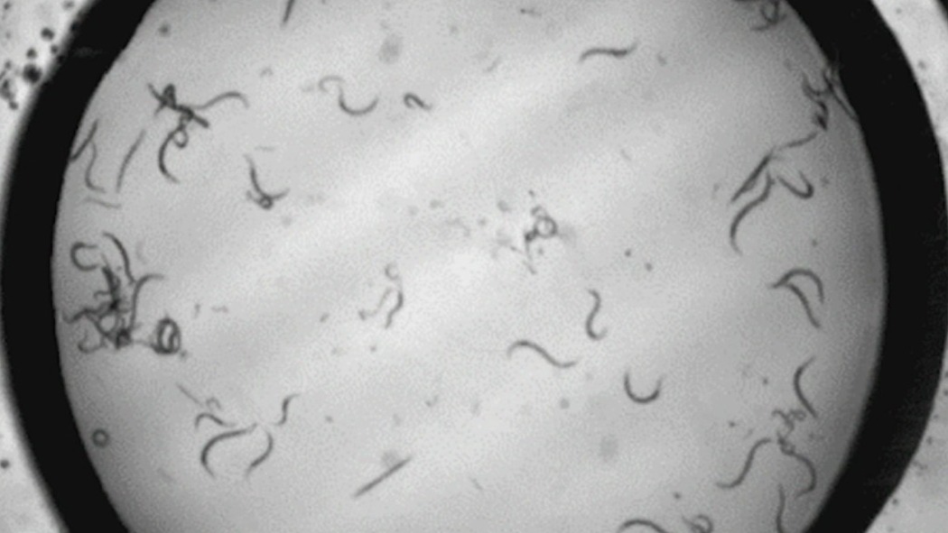 CU researchers use worms, sound in Parkinson’s study – FOX31 Denver