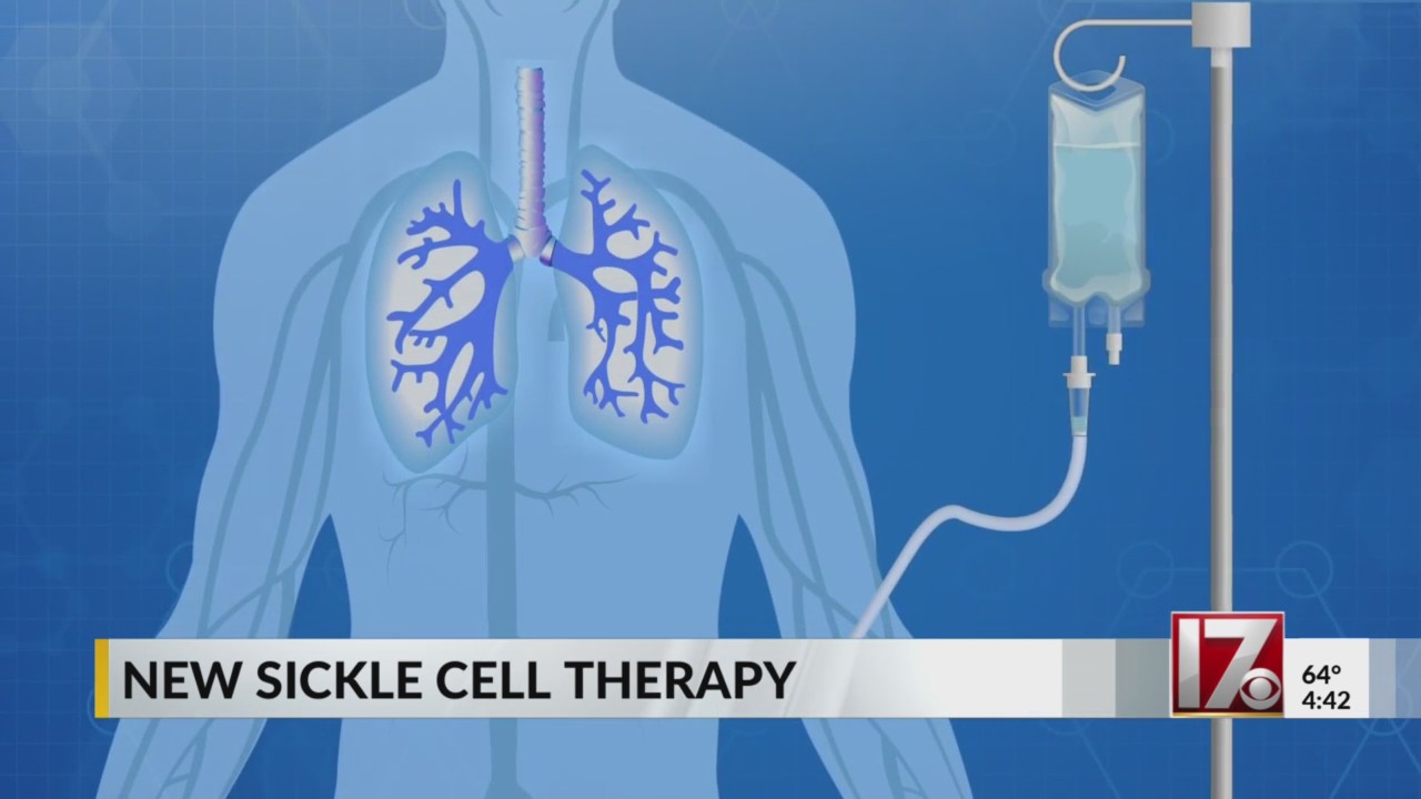 New sickle cell therapy – CBS17.com