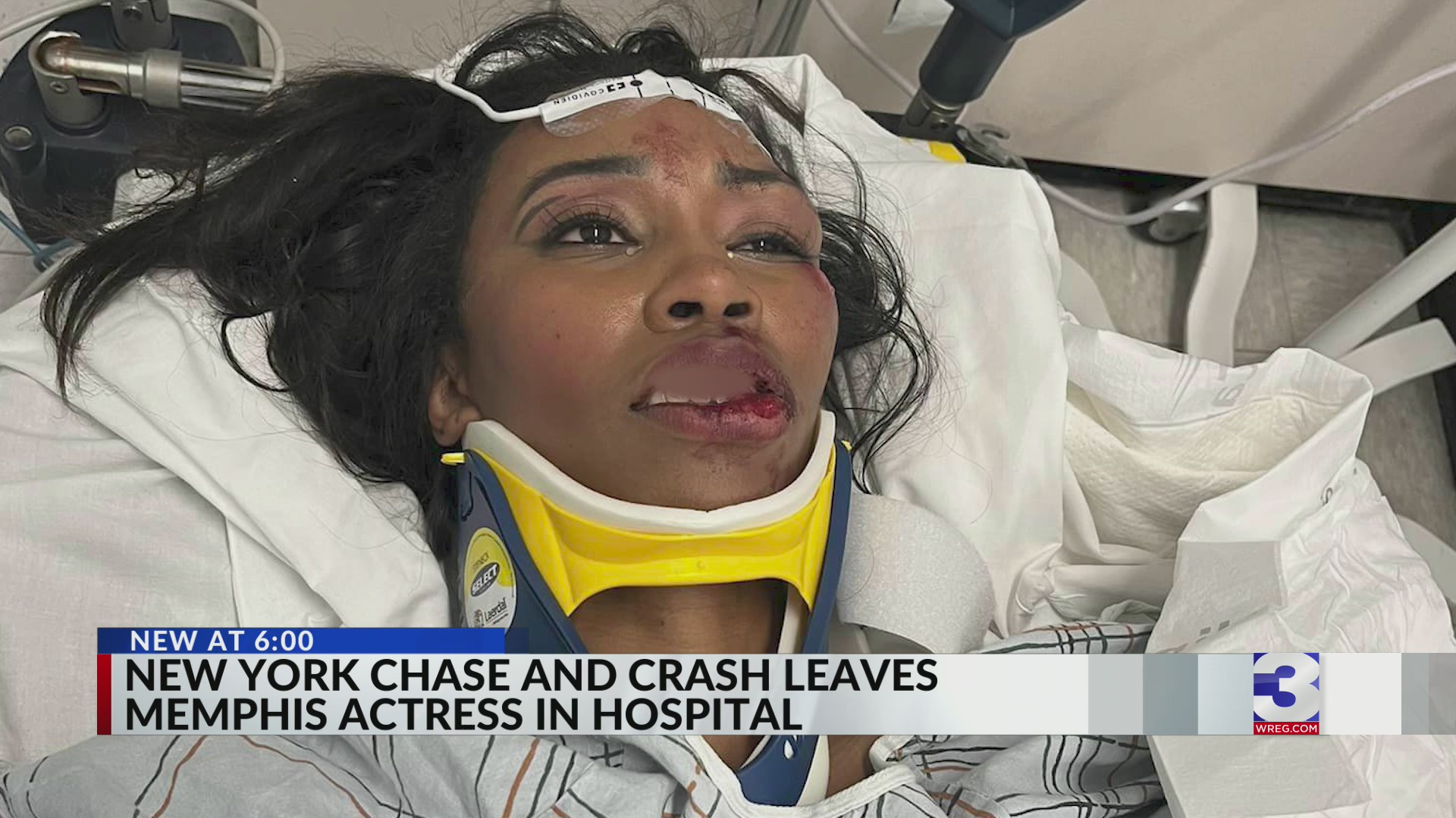 ‘Black Panther’ actress Carrie Bernans hurt in NYC crash – WREG.com