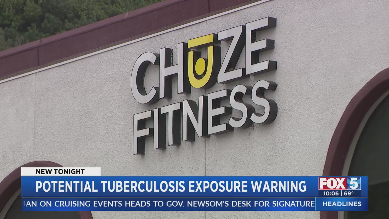 Potential Tuberculosis Exposure Warning – FOX 5 San Diego & KUSI News