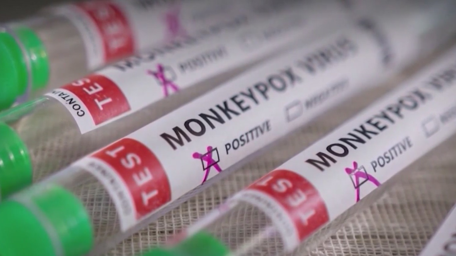 Monkeypox patient says he was misdiagnosed, mistreated in Austin – KXAN Austin