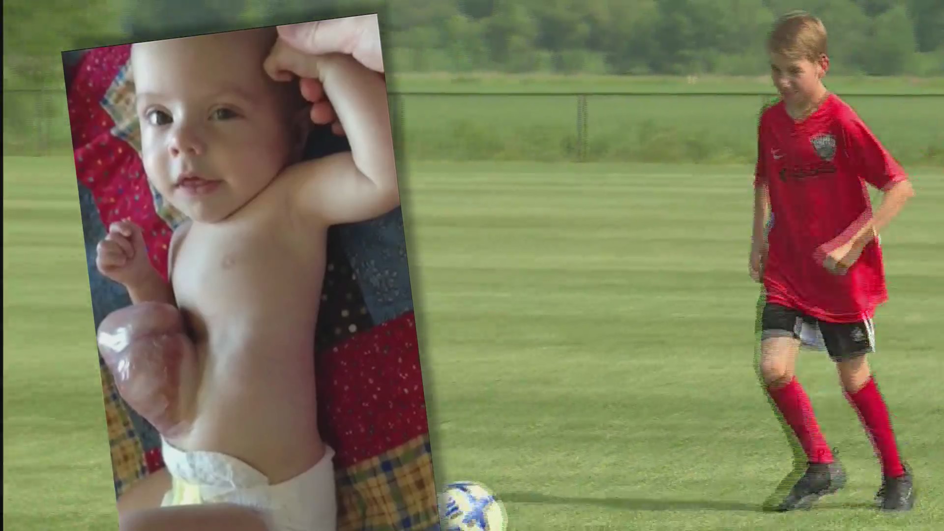 FOX 2 catches up with baby born with organs on outside – FOX 2