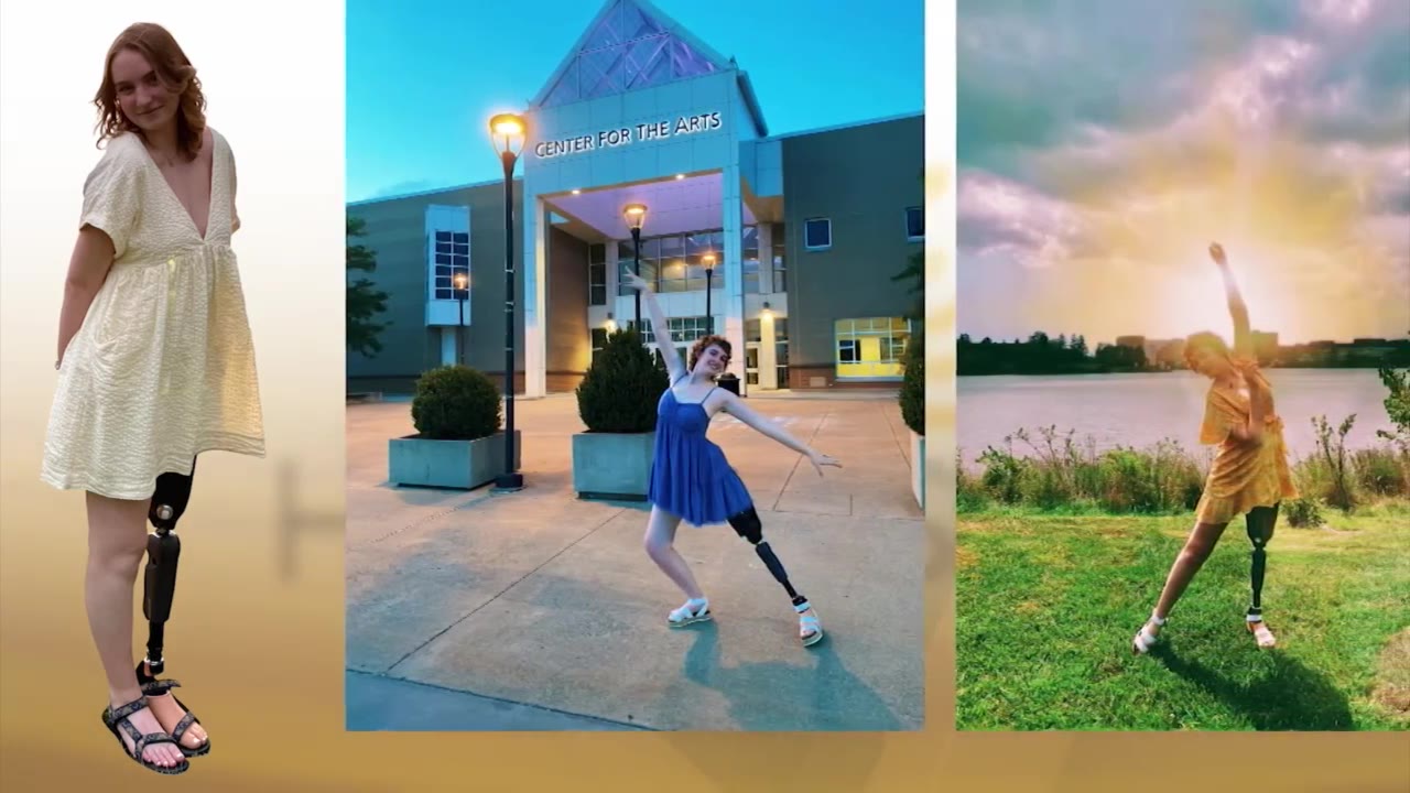 Hope Rises: Ballerina with prosthetic leg featured in People magazine ...