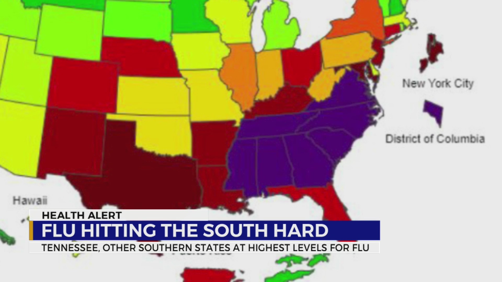 Tennessee among states at the highest levels for flu – WKRN News 2