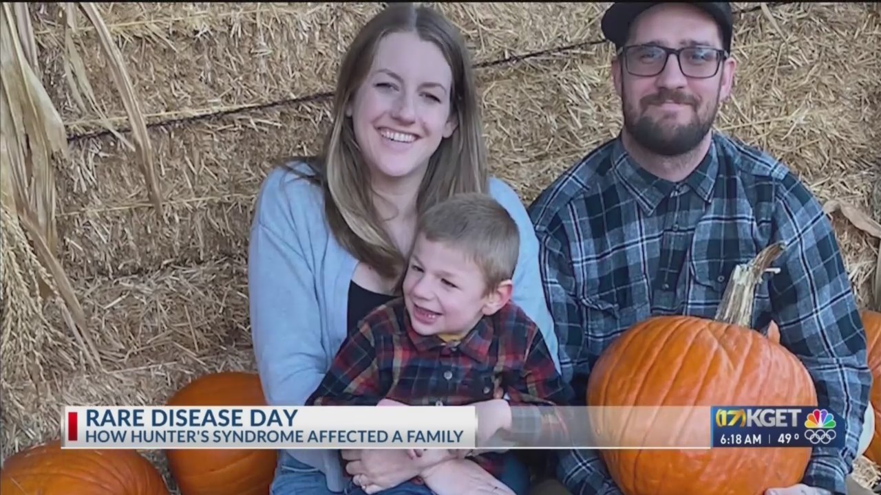 Rare Disease Day: How Hunters syndrome affected a family – KGET 17 News