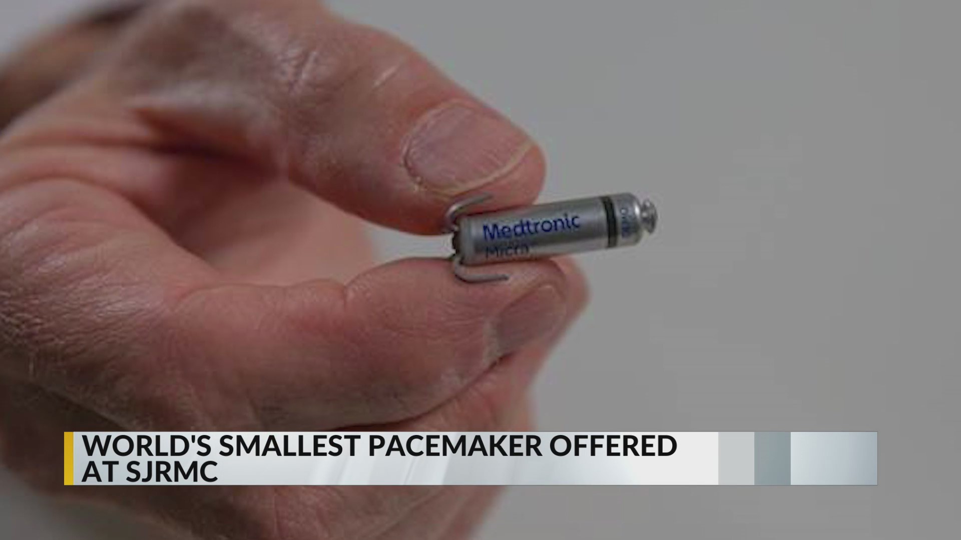 World’s smallest pacemaker now available at San Juan Regional Medical ...