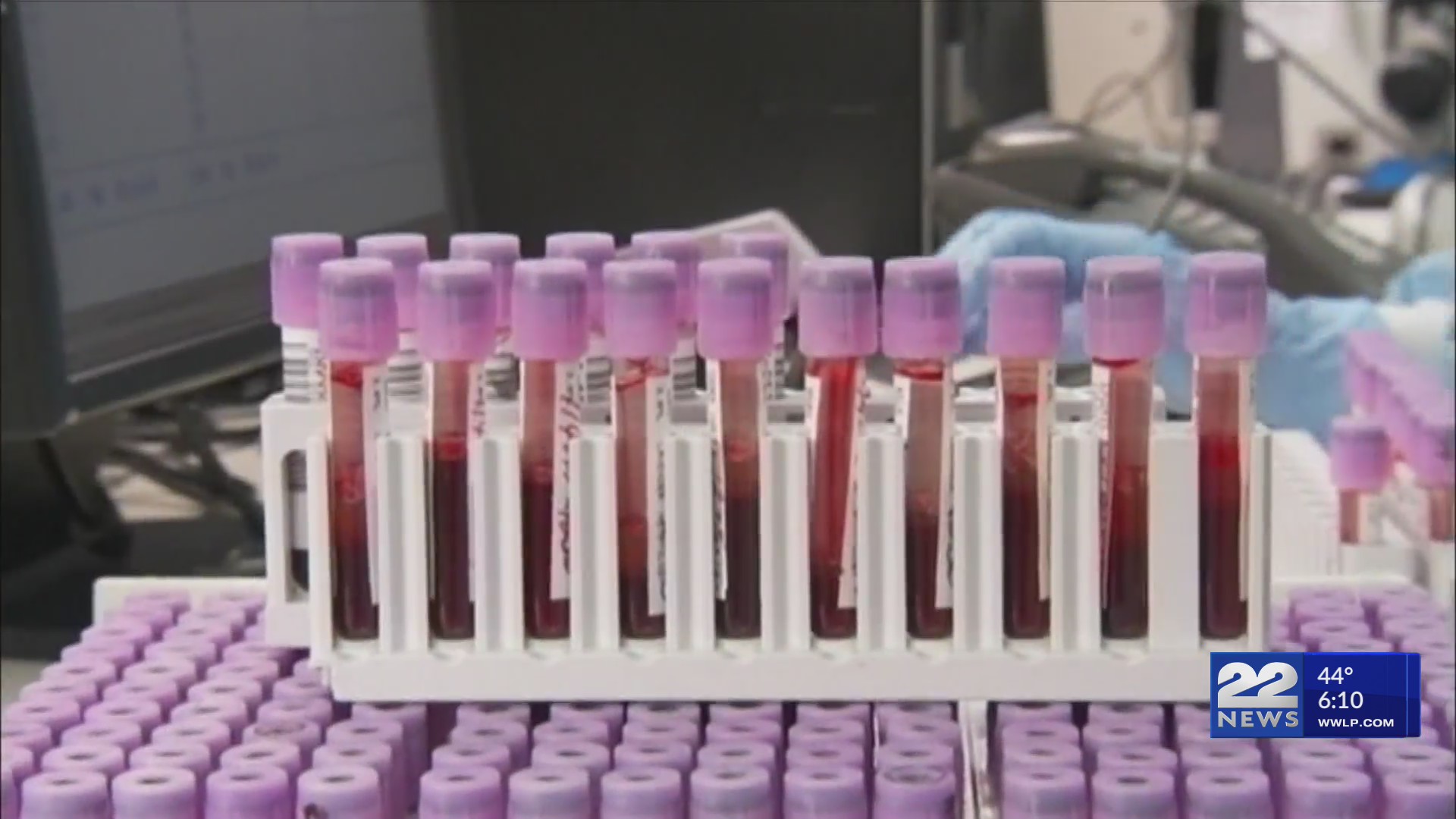 African American men disproportionately impacted by prostate cancer – WWLP