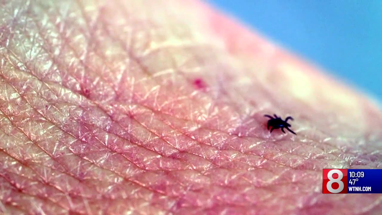 CDC: Tickborne diseases up 25% in the U.S. – WTNH.com