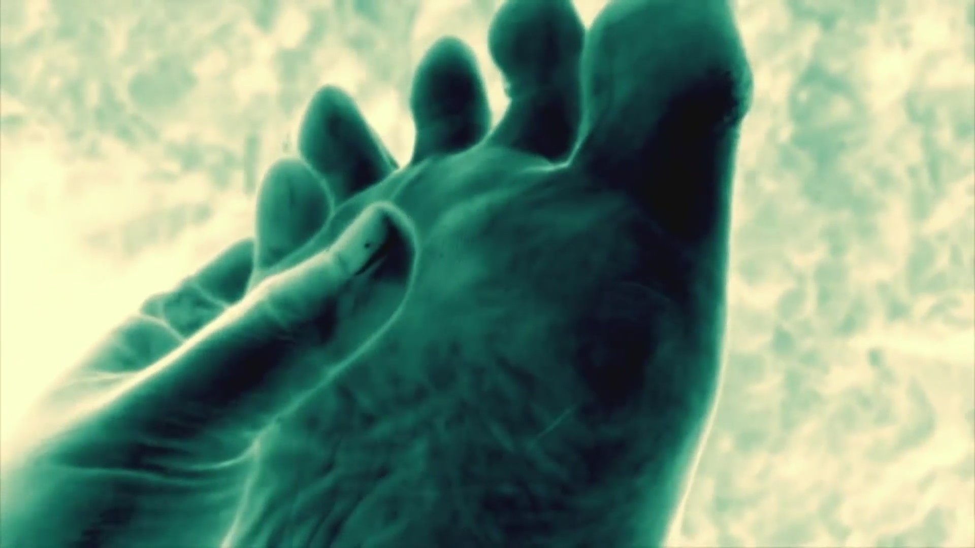 Hypothermia and frostbite: What are the differences? – FOX31 Denver