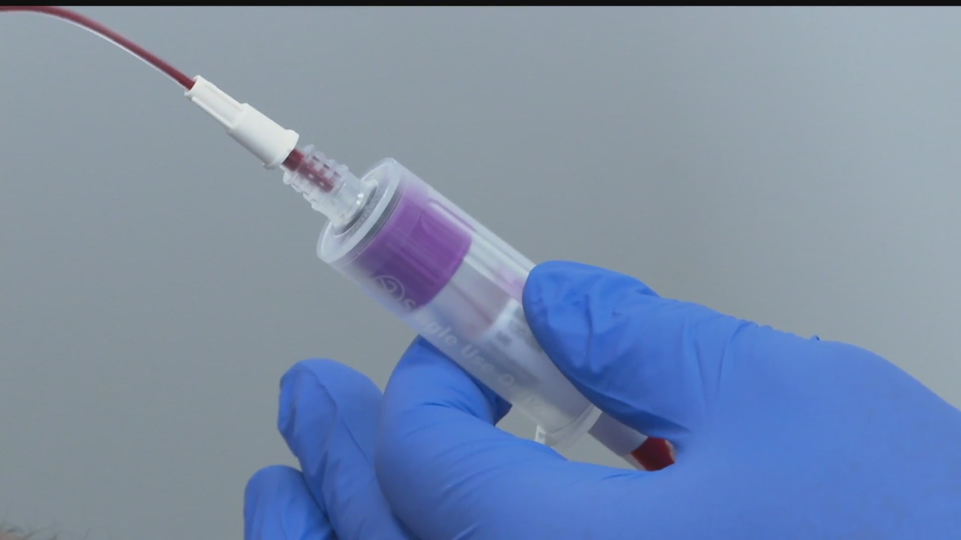 Len Rome’s Local Health: Lung cancer detection – WYTV