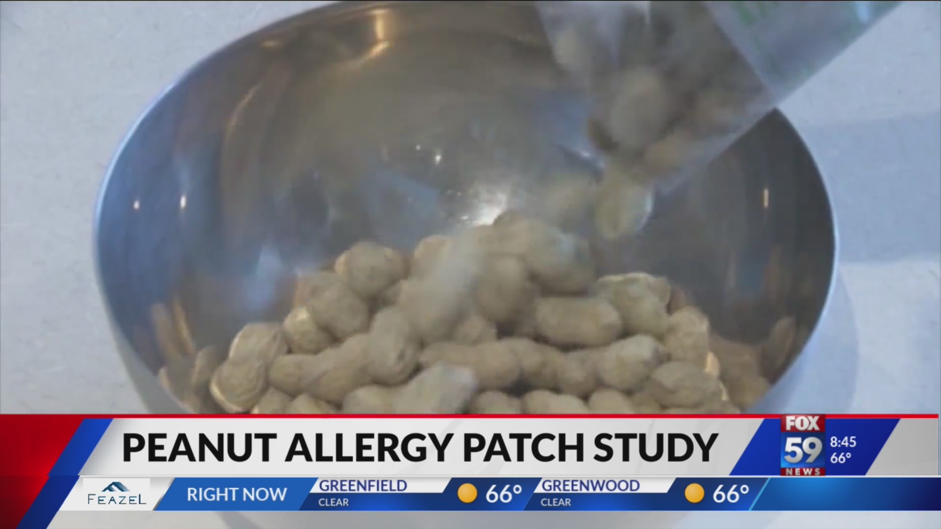 Peanut allergy patch study – Fox 59