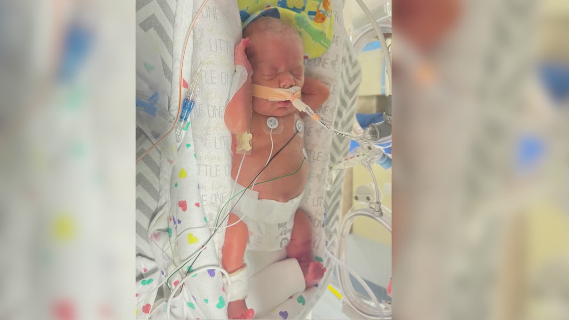 Baby born at 23 weeks old – FOX31 Denver