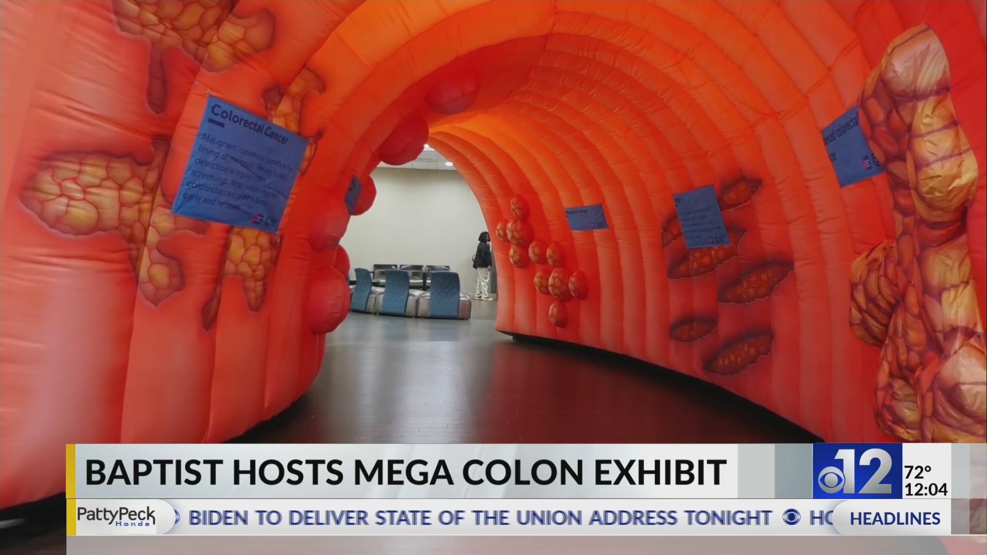 Baptist hosts Mega Colon exhibit – WJTV