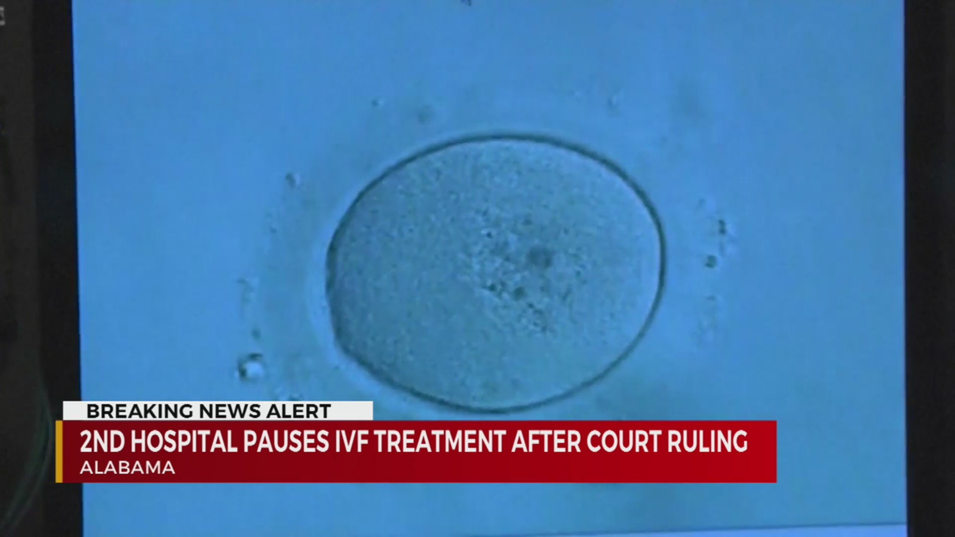 Second Alabama hospital pauses IVF treatment after court ruling – WKRN ... Second Alabama hospital pauses IVF treatment after court ruling – WKRN ...
