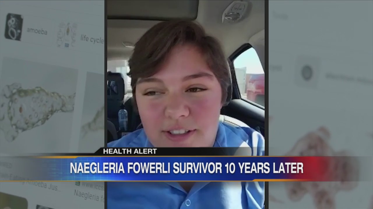 Arkansan Kali Hardig shares story of surviving brain-eating amoeba 10 ...