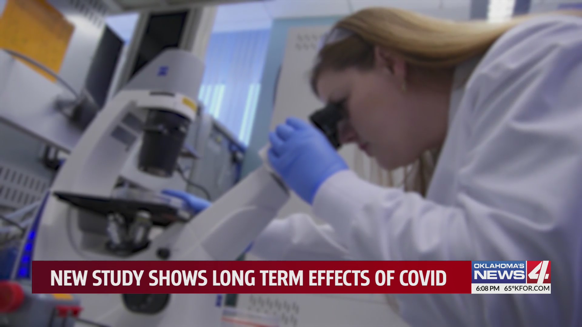 New study shows long term effects of COVID – KFOR.com Oklahoma City