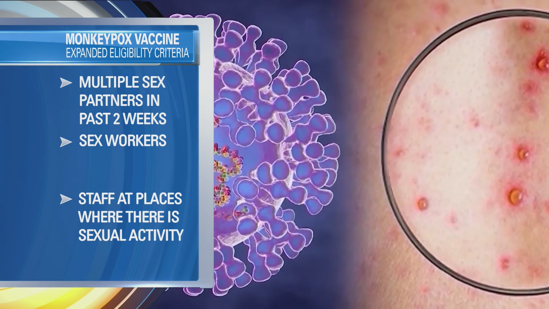 VDH expands monkeypox vaccine eligibility in Virginia – WAVY.com