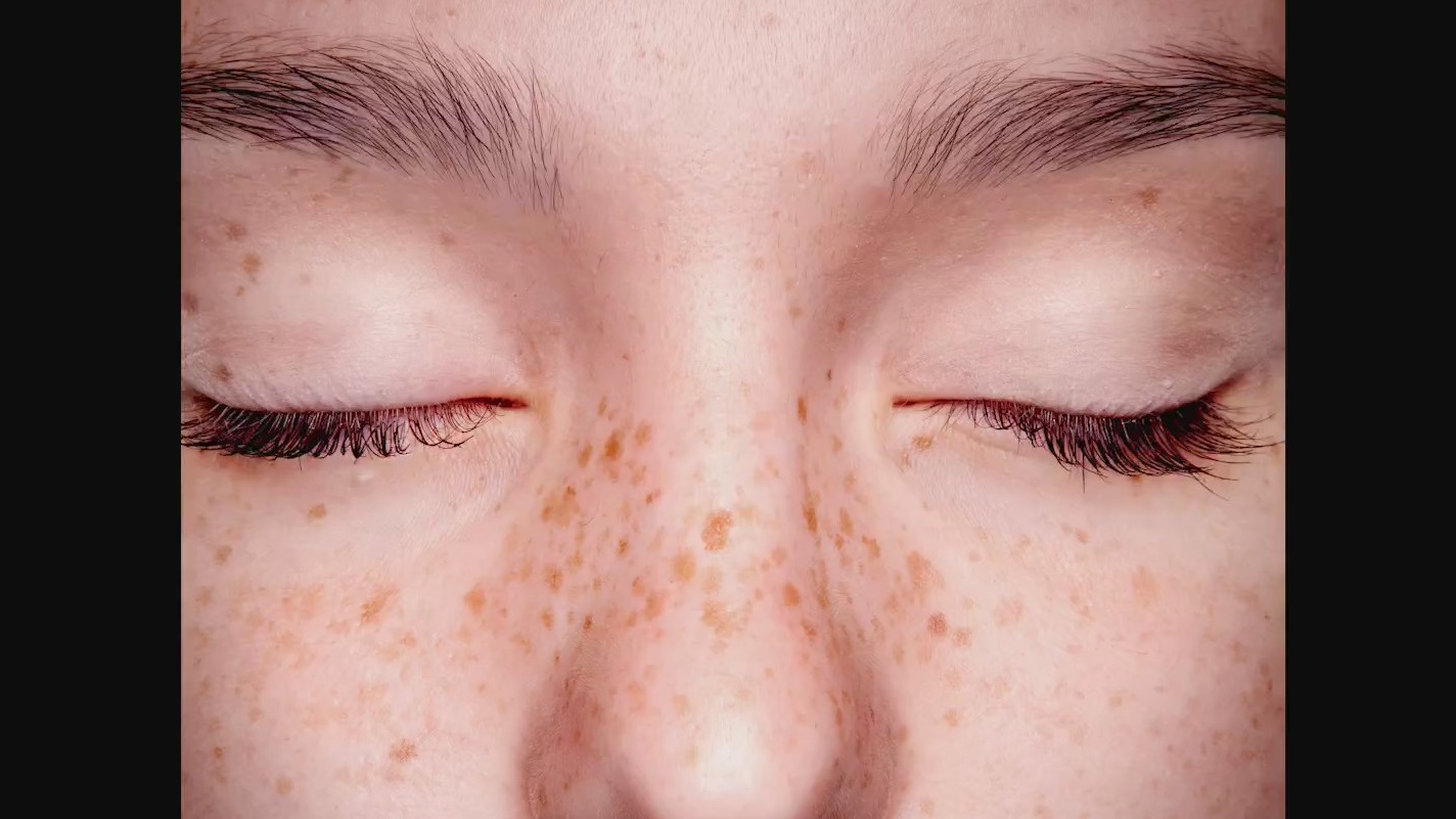 Clever hack uses a common vegetable to create faux freckles – WGN-TV