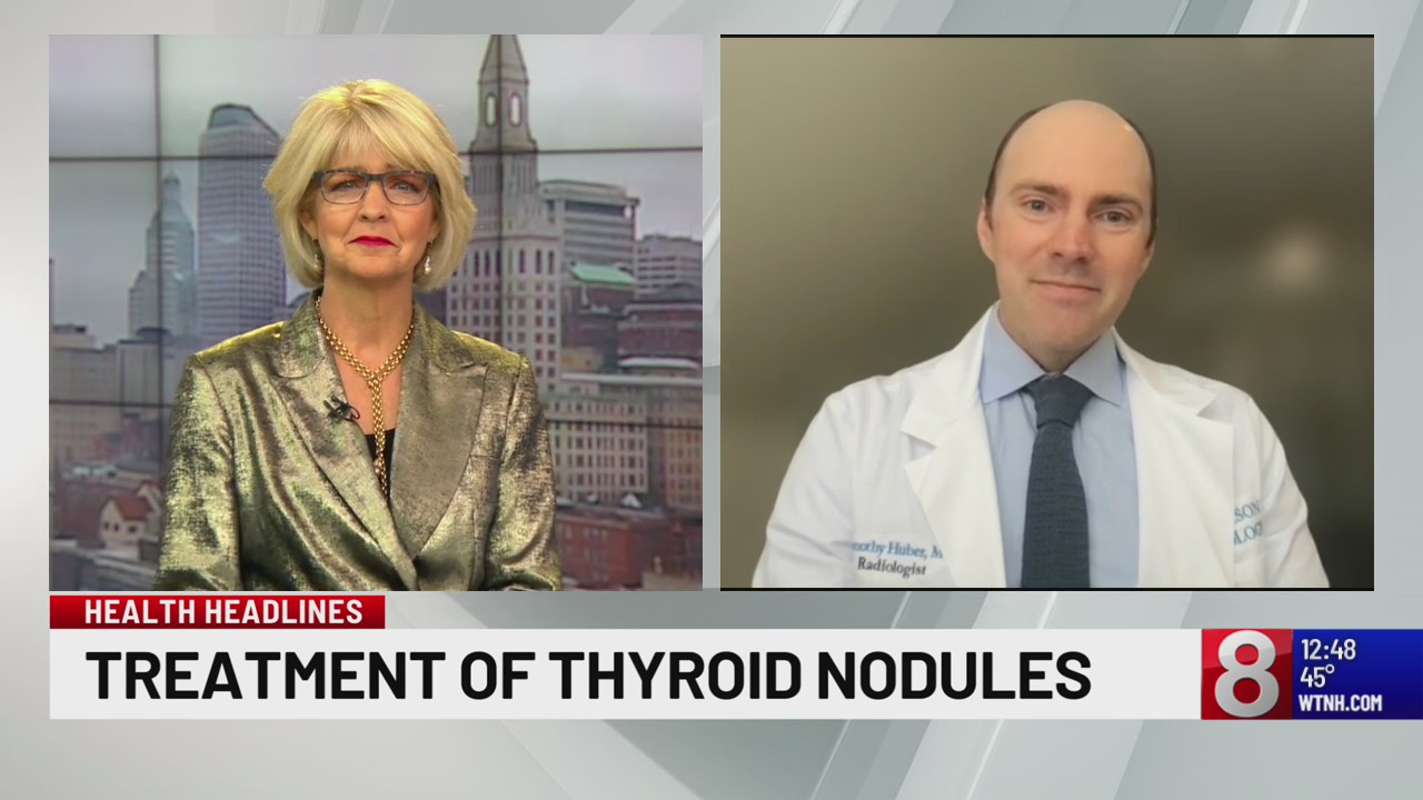 Treating thyroid nodules – WTNH.com
