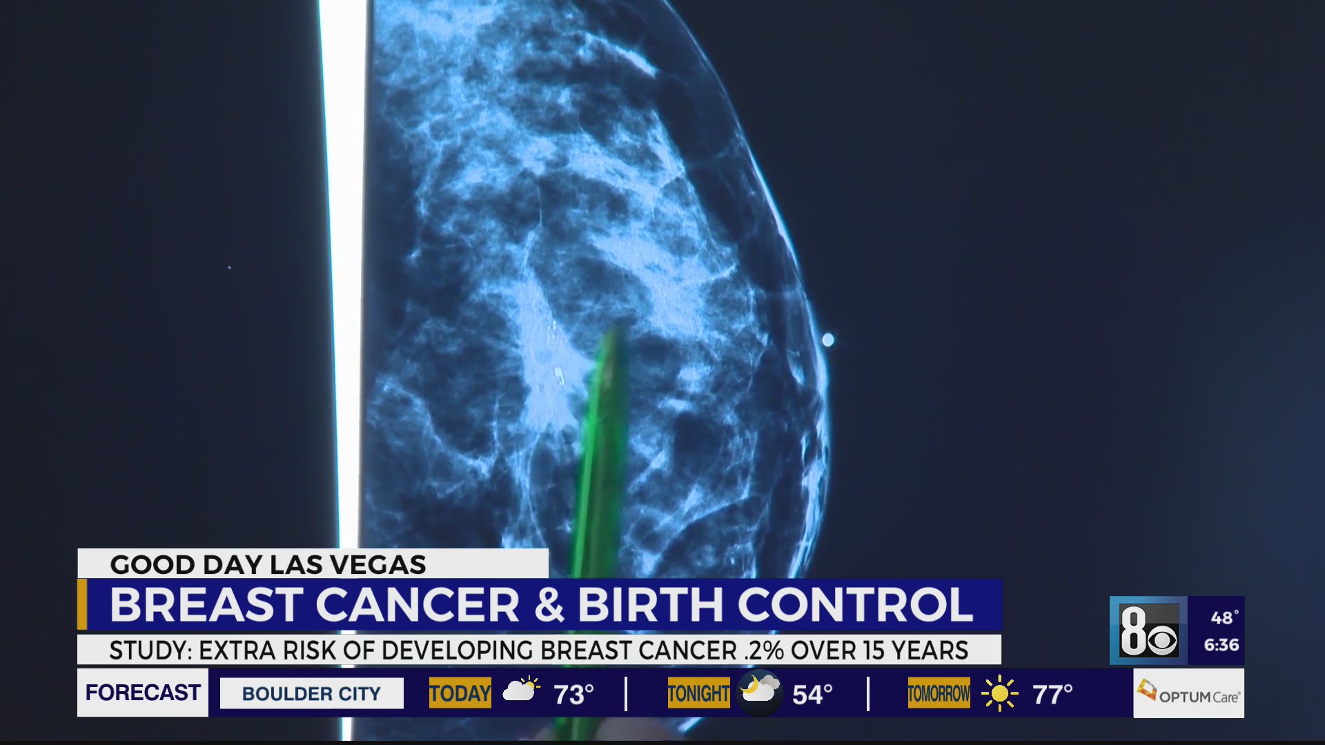 Study shows link between birth control pills and breast cancer – KLAS