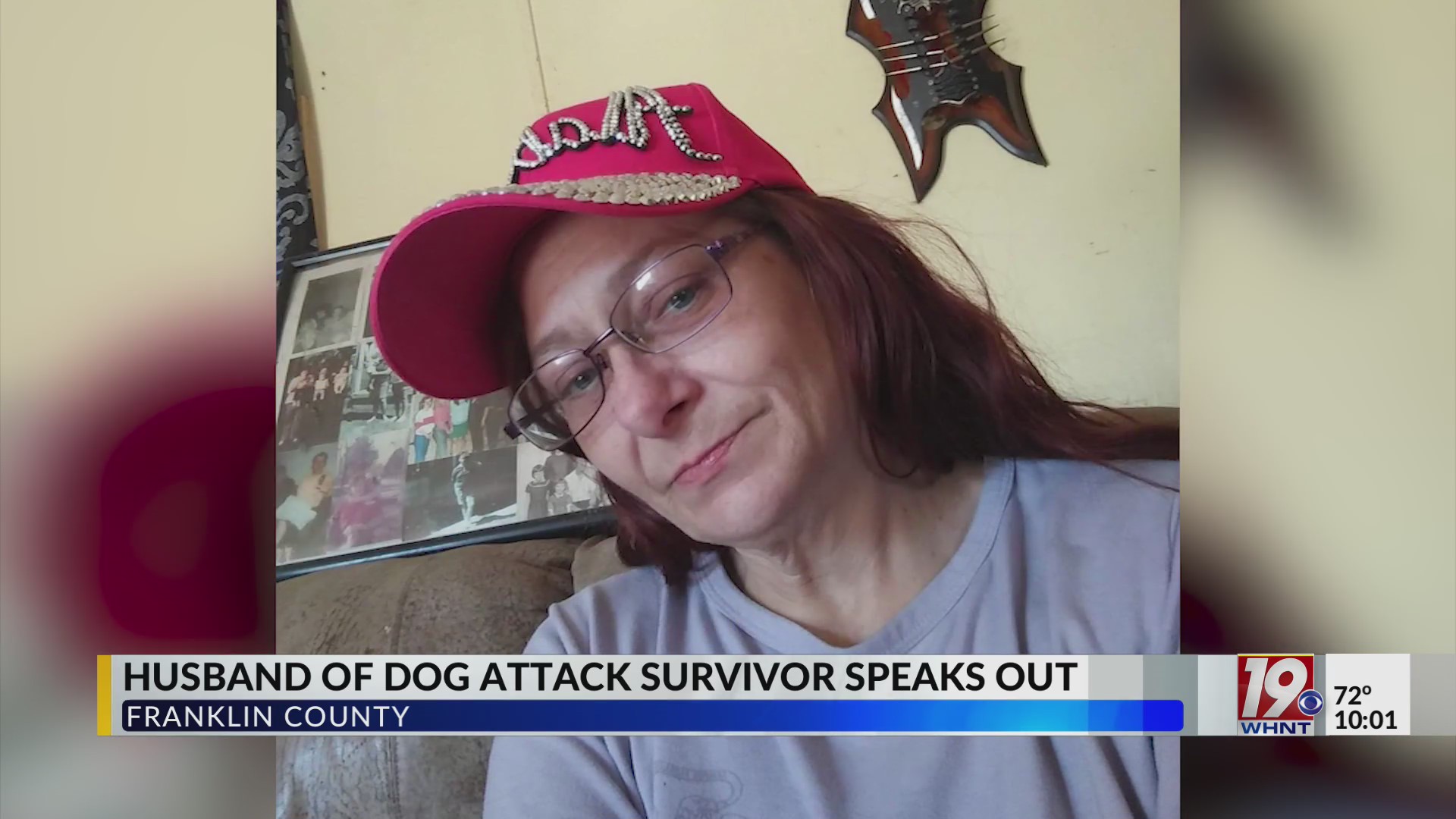 Husband of Dog Attack Survivor Speaks Out – WHNT.com