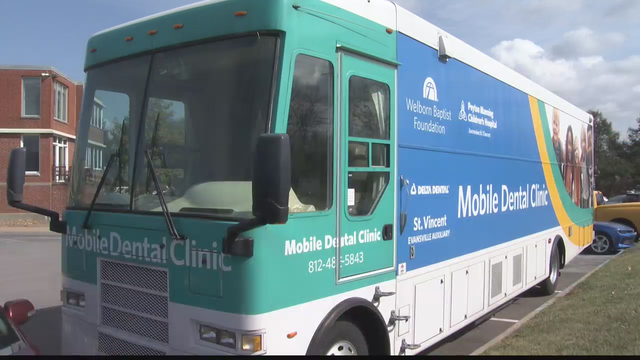 Ascension St. Vincent hosts mobile dental clinic – Eyewitness News (WEHT/WTVW)