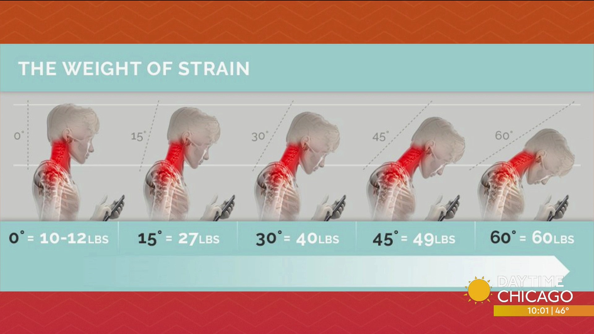 Prevent ‘Tech Neck’ with these posture tips – WGN-TV