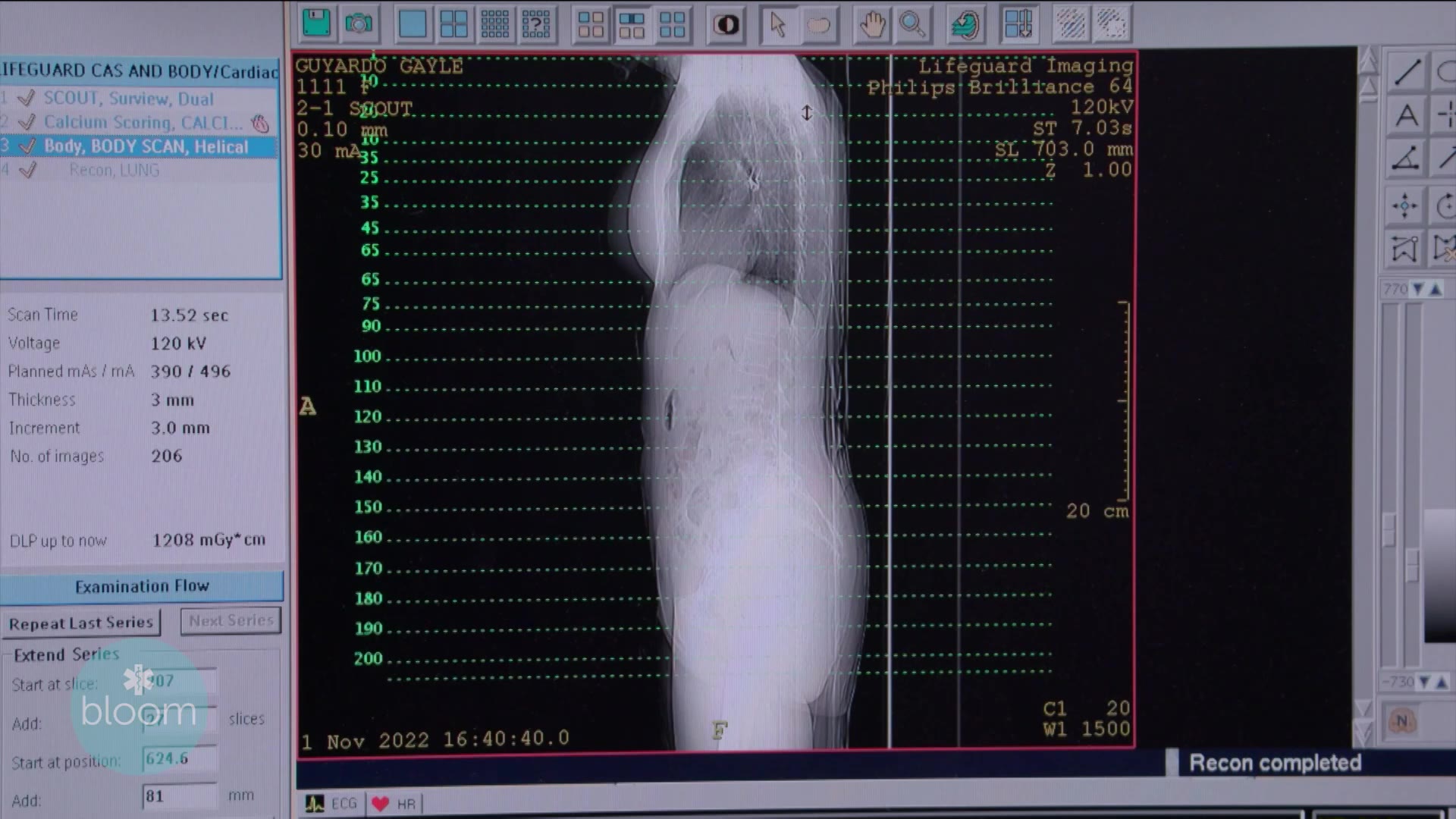 Early Detection Saves Lives – LIFEGUARD IMAGING – WFLA