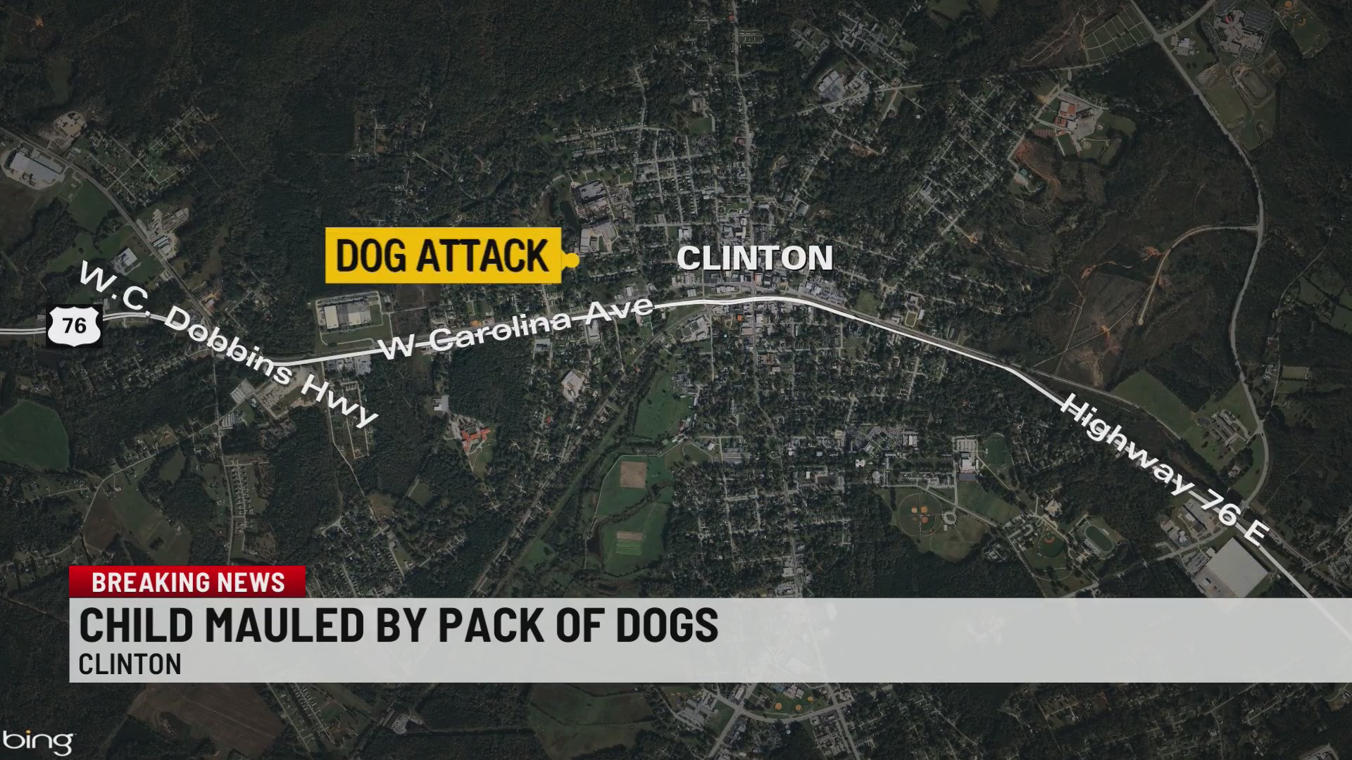 11-year-old mauled by dogs at Clinton bus stop – WSPA 7NEWS