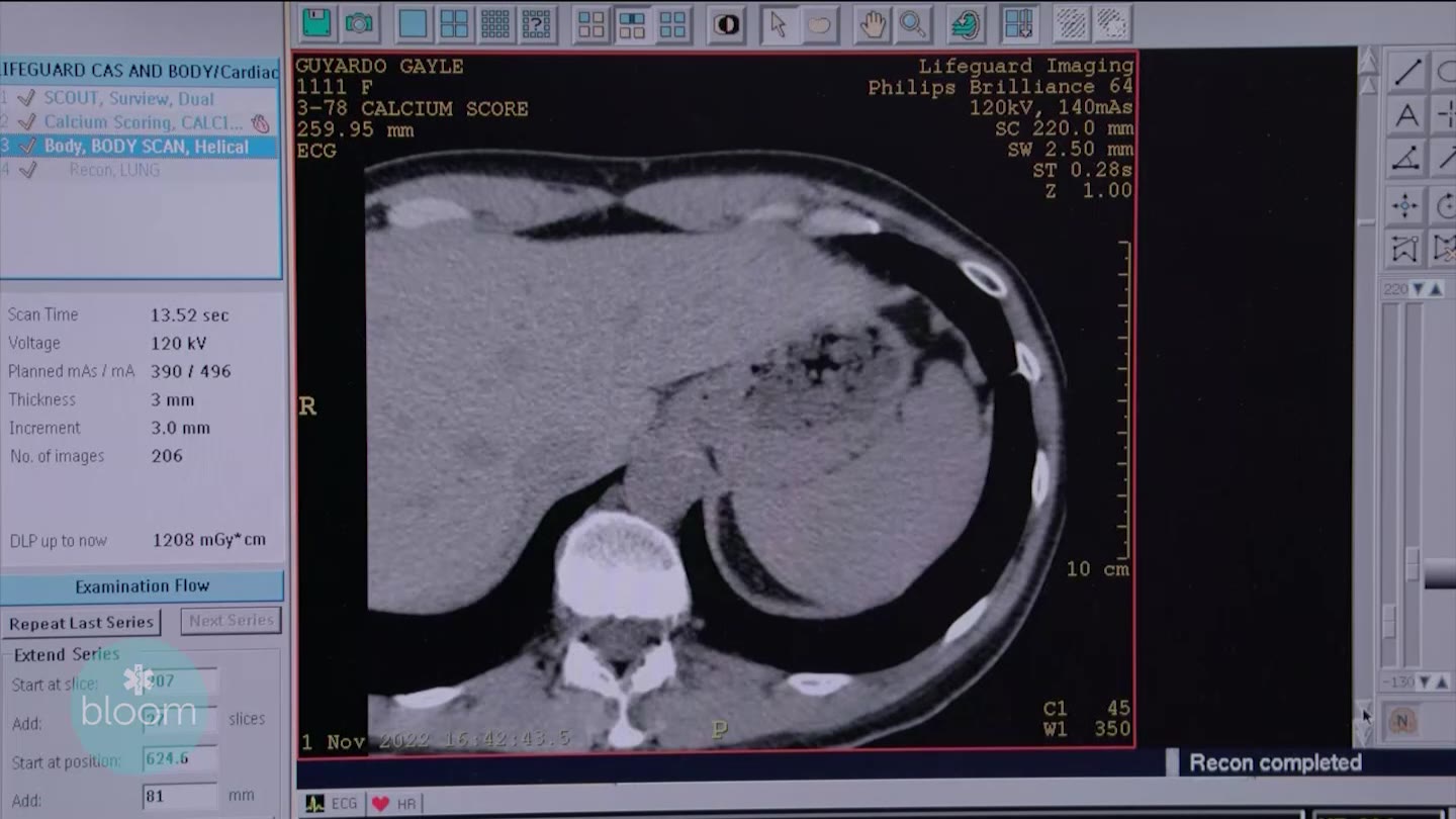 Life Guard Imaging: Early Detection Saves Lives – WFLA