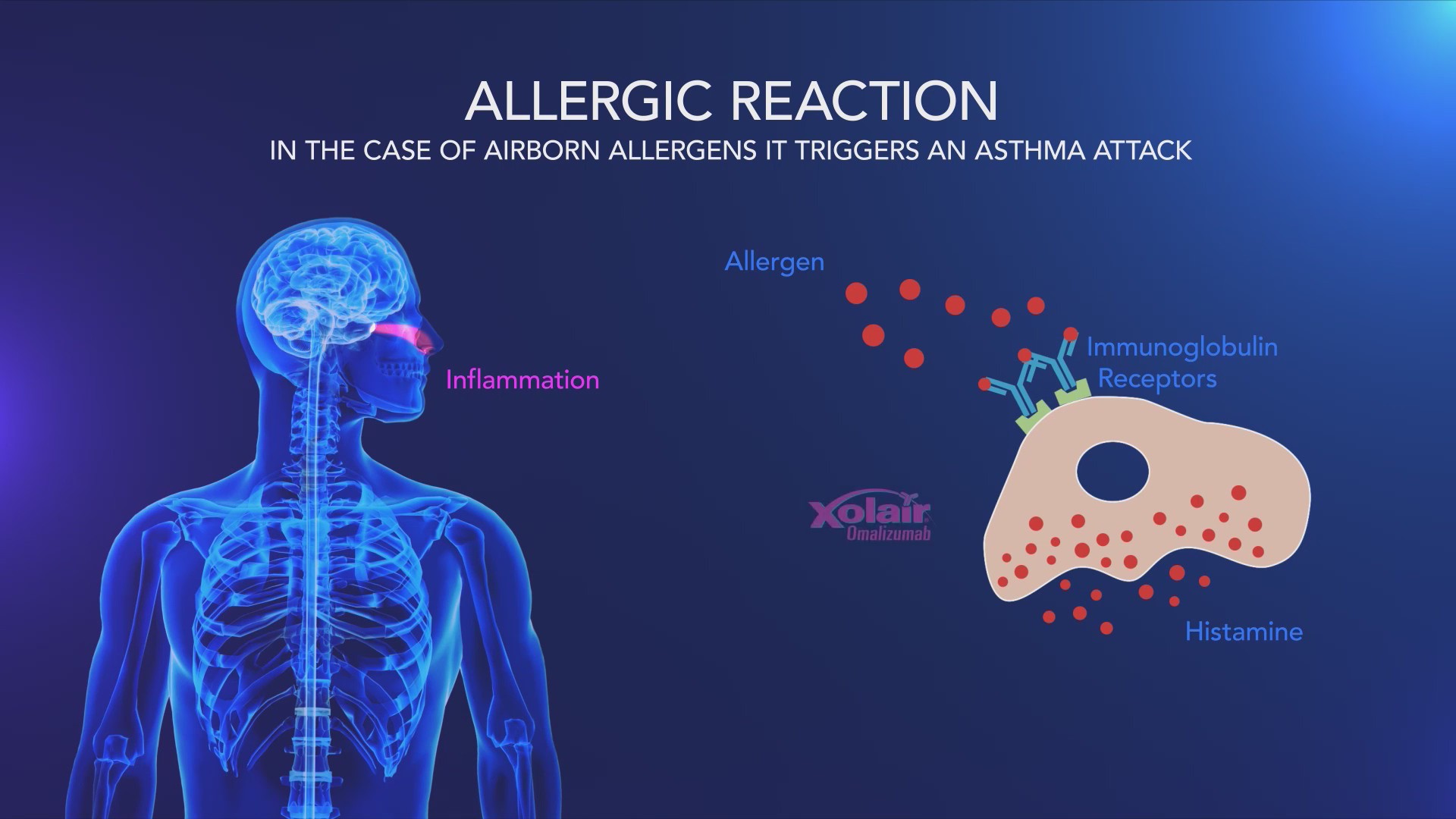 Asthma medication now approved to help with food allergies – FOX 2