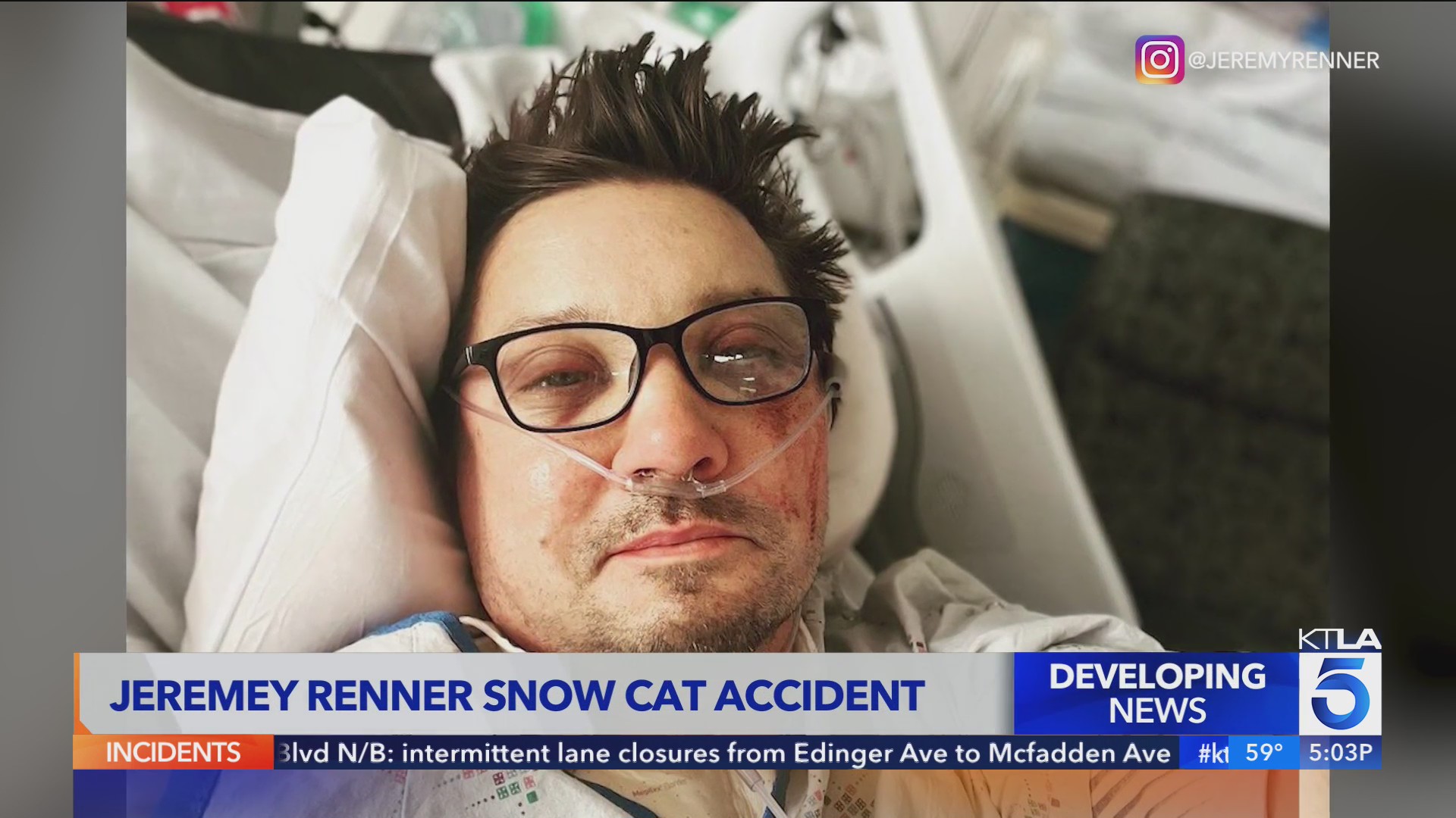 Jeremy Renner shares message and photo from hospital – WJBF