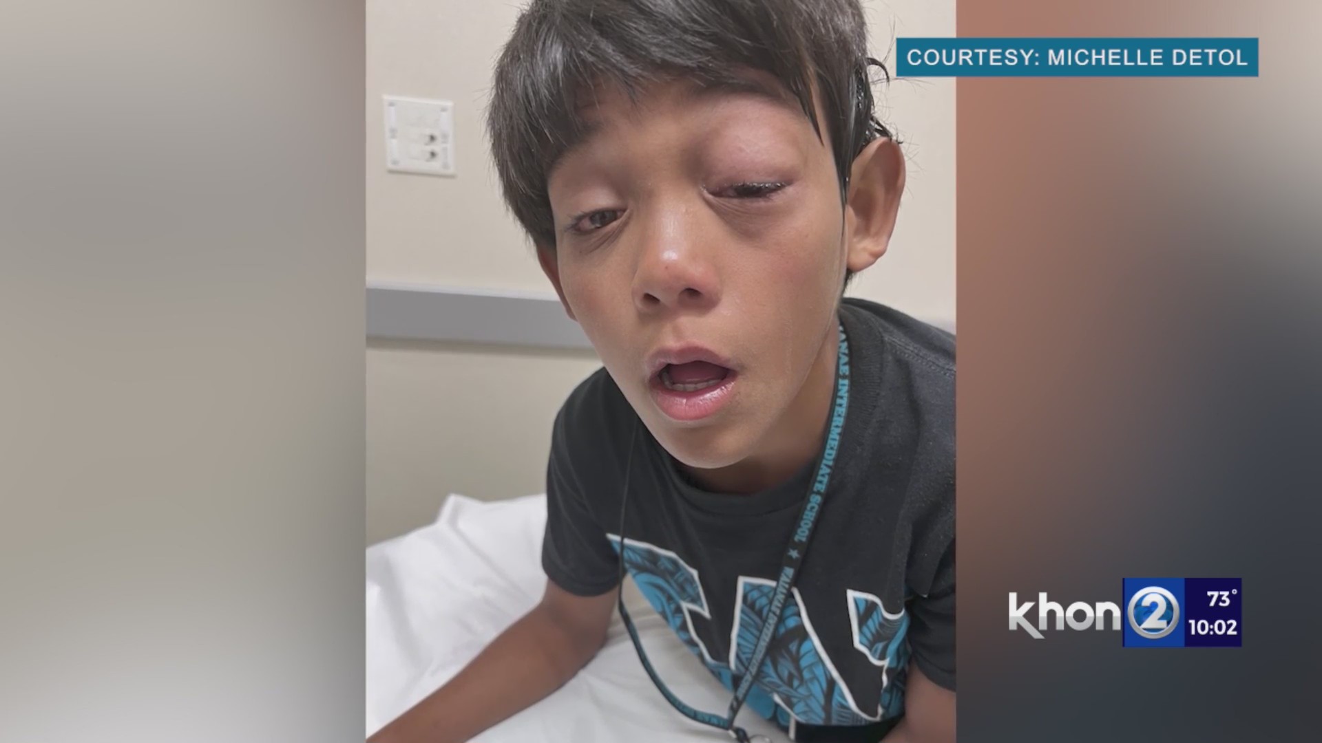 Boy left with severe eye injury after incident with hand sanitizer at ...