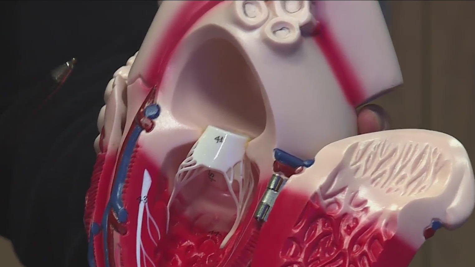‘More than just the science’: OHSU patient shares story at World Heart ...