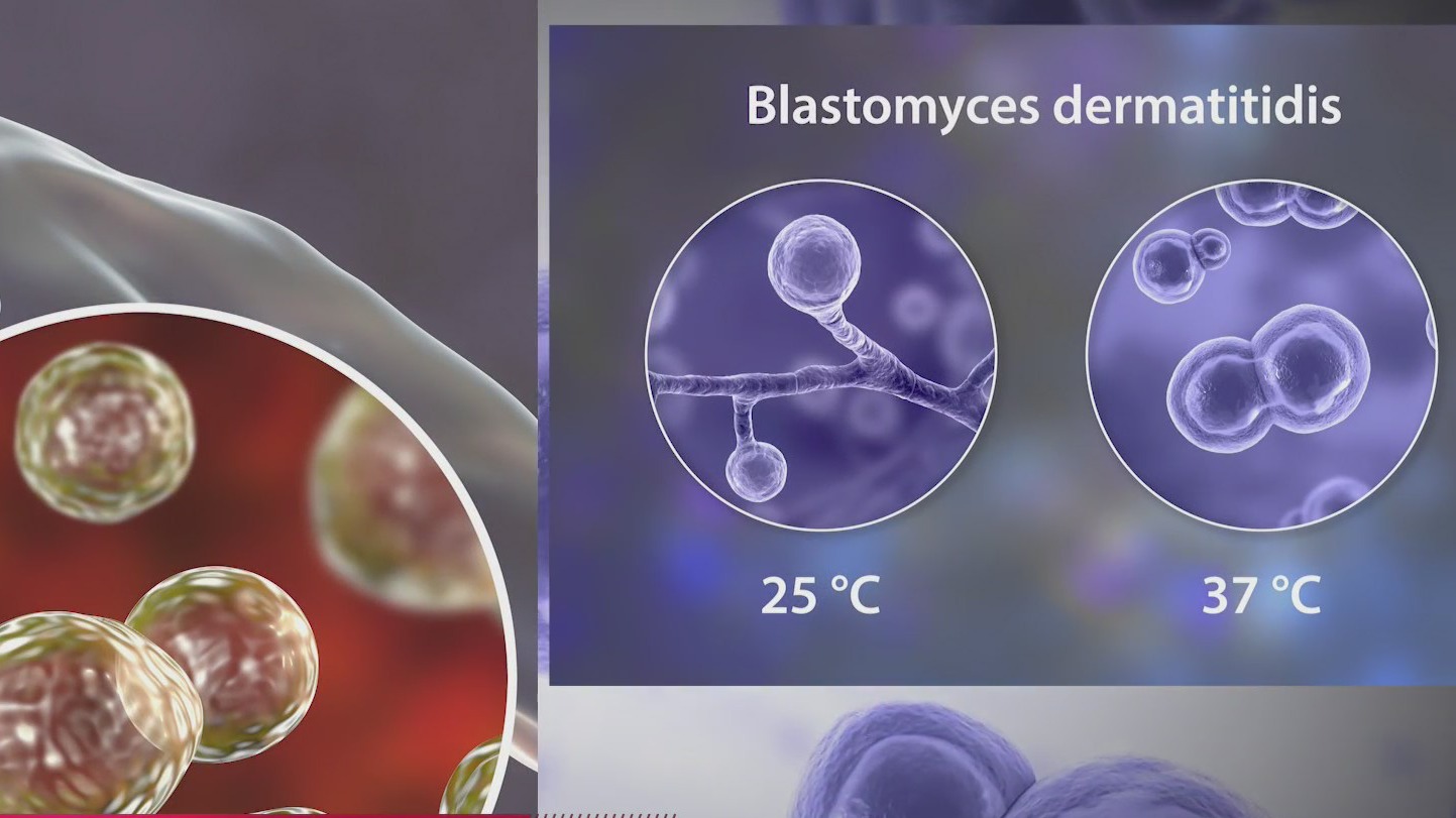 Rare fungus causes outbreak at Michigan paper mill | Rush Hour – NewsNation