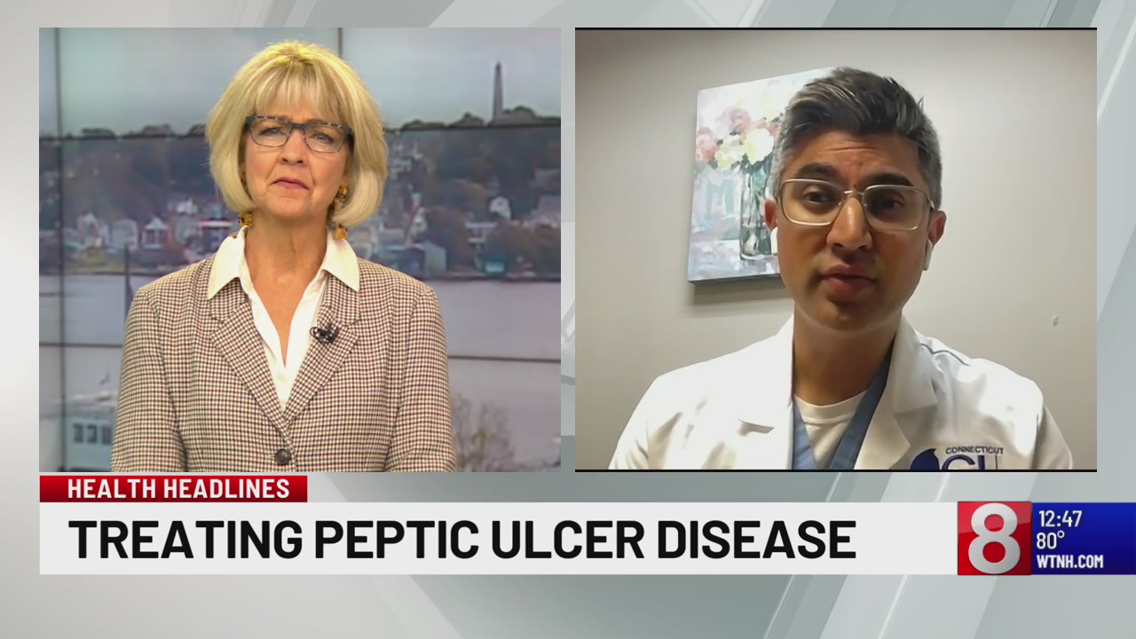 Treating peptic ulcer disease – WTNH.com