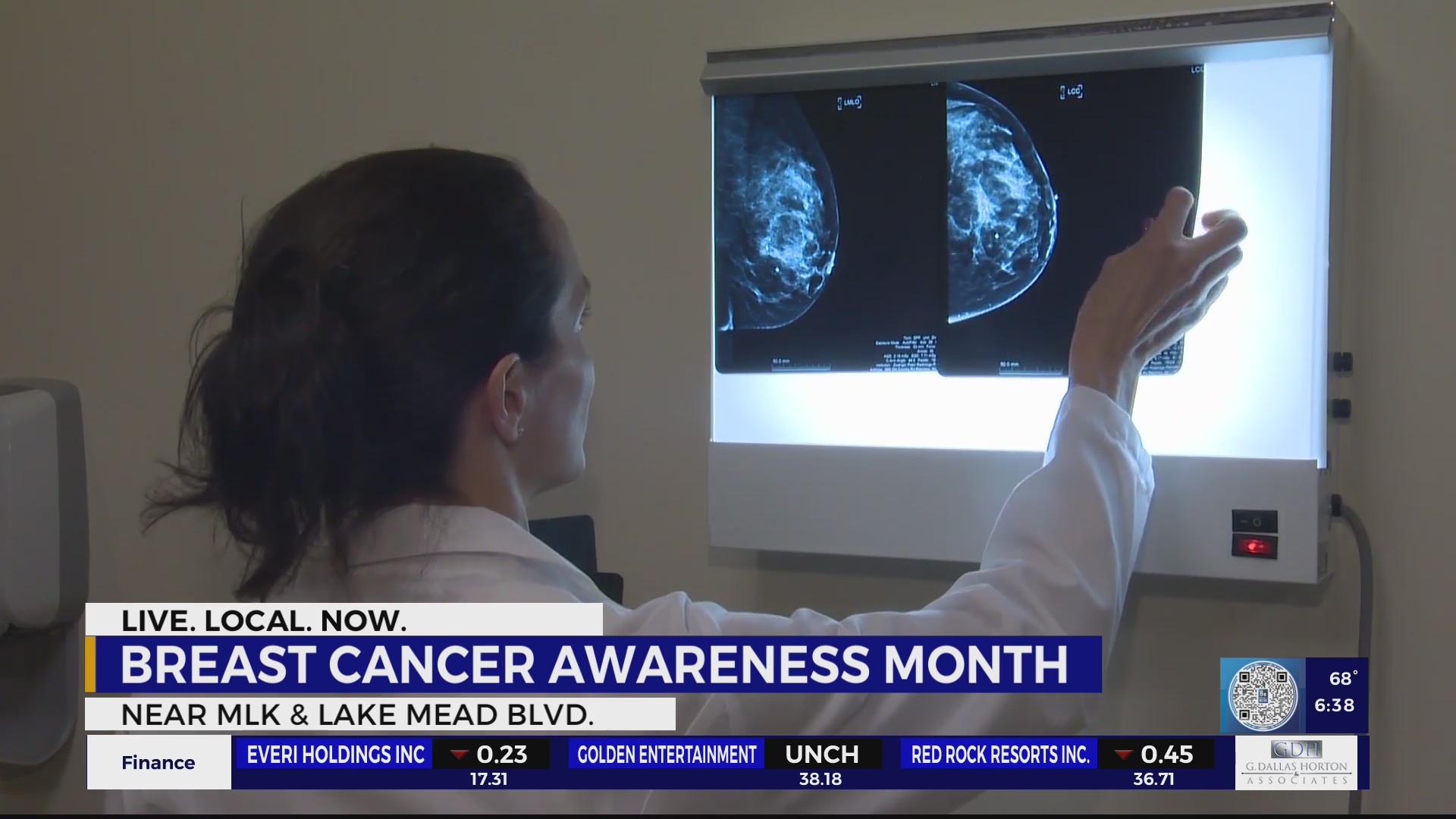 Mammovan makes getting breast cancer checks more convenient – KLAS